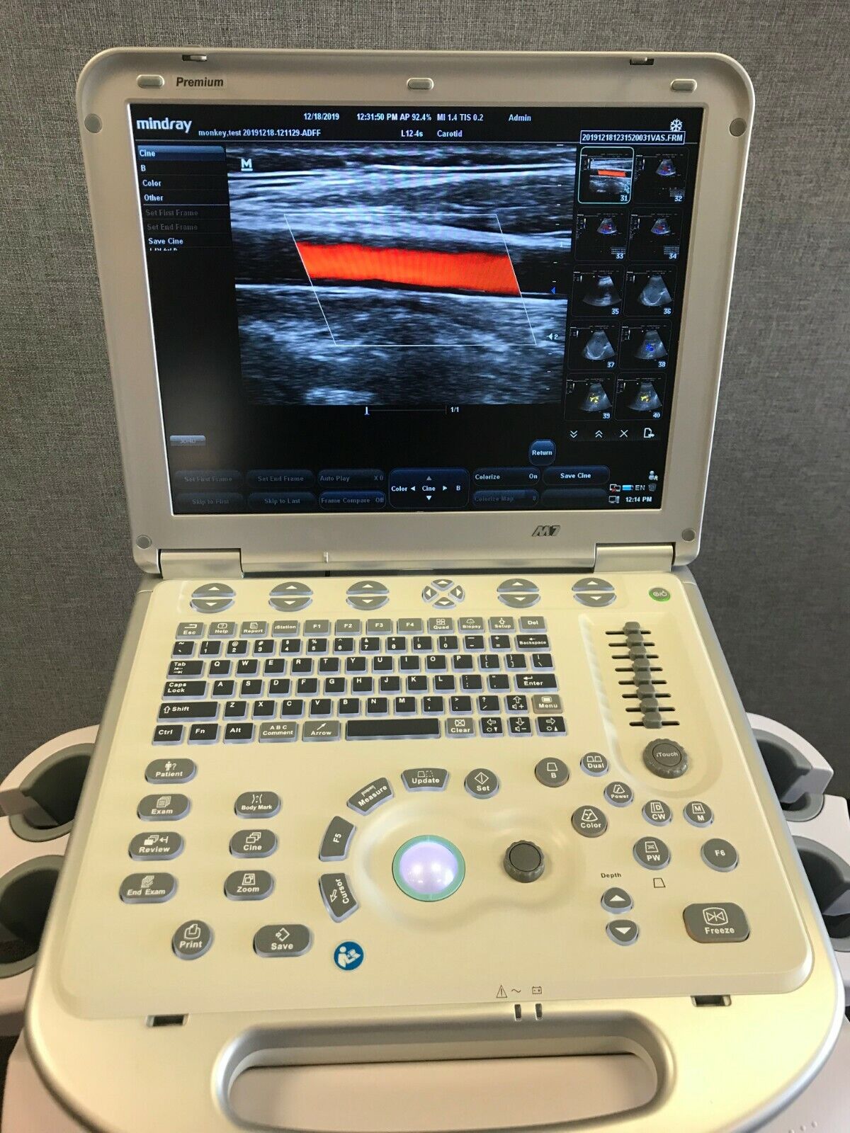 Mindray M7 Ultrasound Machine | Viva Kleinanzeigen